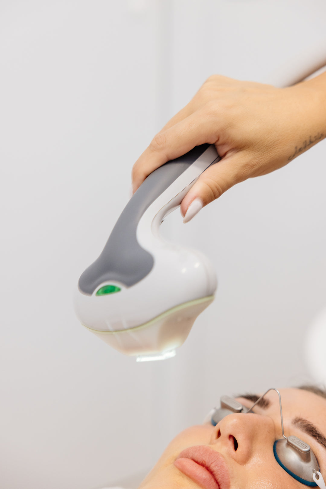CUTERA LIMELIGHT IPL – Higher Self Skin